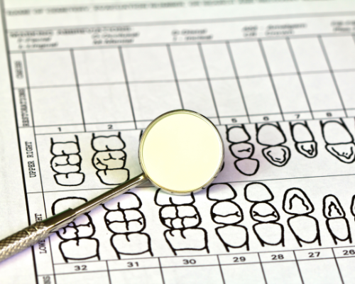 What Is Periodontal Charting?